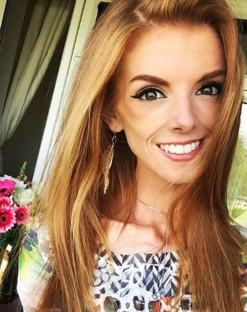 28 kiloya kadar düşen Annie Windley'nin hayatını bir parça çikolata ...