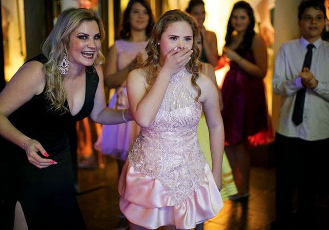 Down sendromlu model Georgia Traebert herkese ilham oluyor