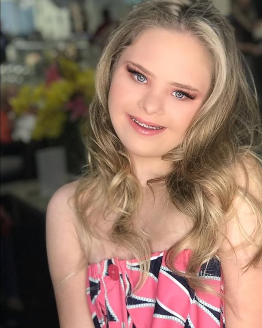 Down sendromlu model Georgia Traebert herkese ilham oluyor