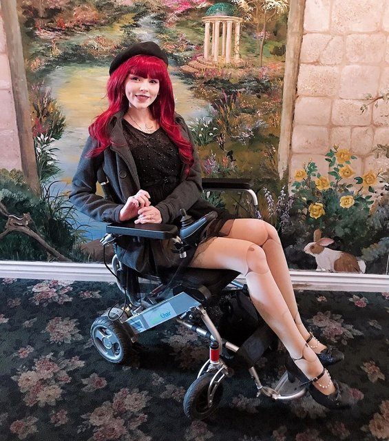 Musküler Distrofi hastası Amber Guzman hayata böyle sarıldı | Sağlık ...