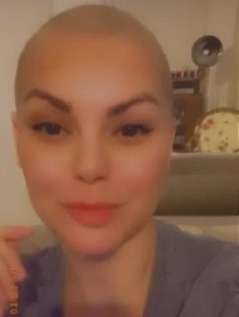 Şarkıcı Nez saçlarını kazıttı! Nez Instagram'dan paylaştı - Son dakika ...