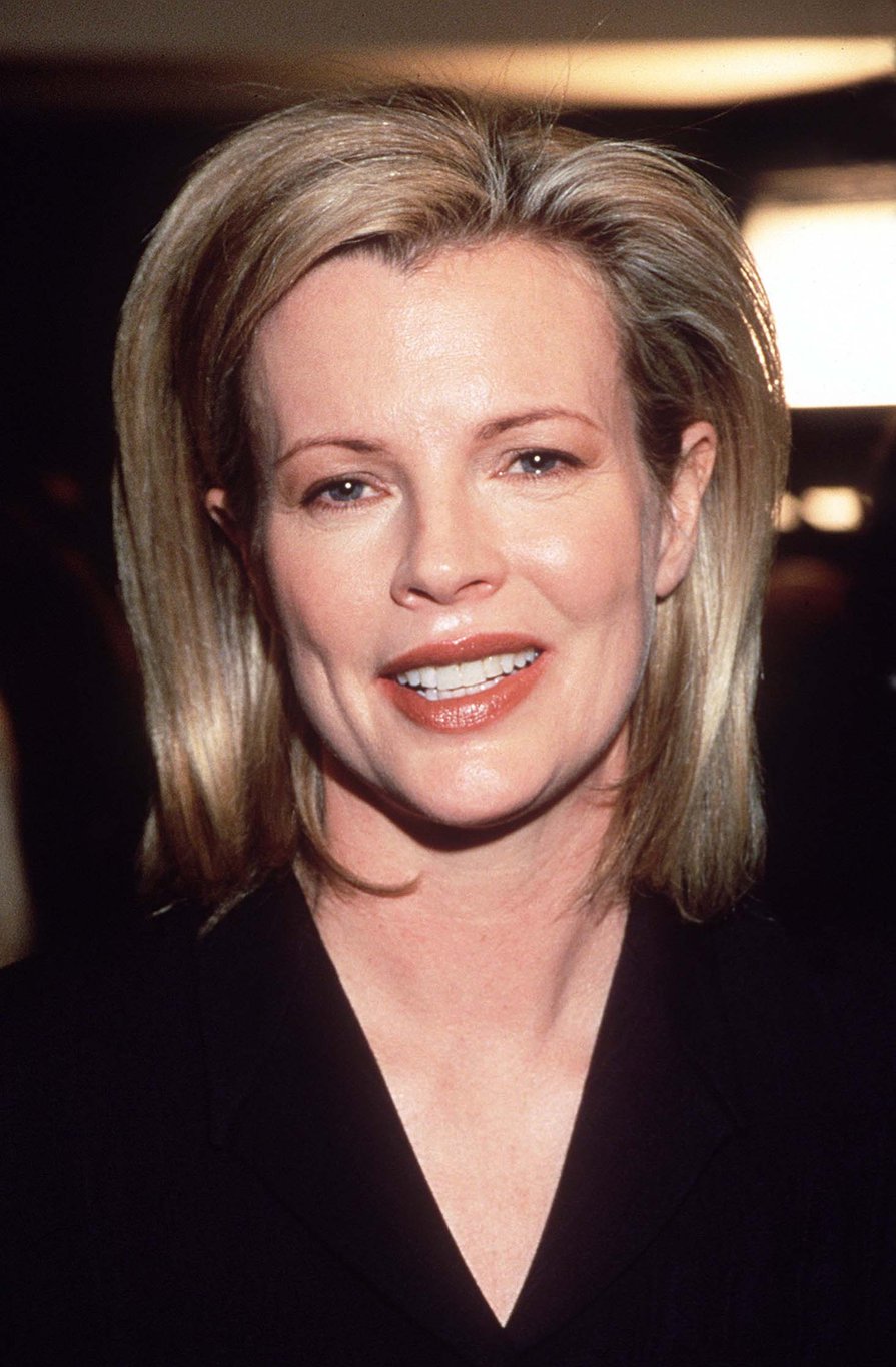 Kim Basinger'ın yüzünün geçirdiği değişim şaşırttı