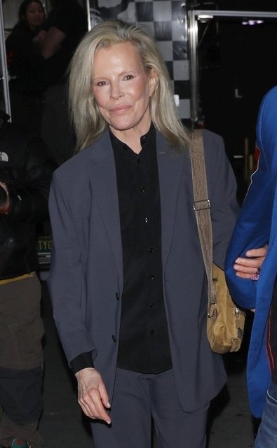 Kim Basinger'ın yüzünün geçirdiği değişim şaşırttı