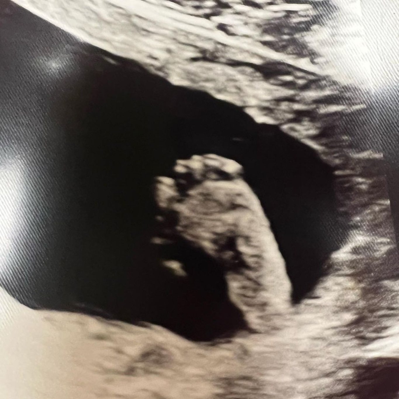 Ortalık karıştı! Bora Akkaş'ın hamile eşi Oben Alkan gelen yoruma ...