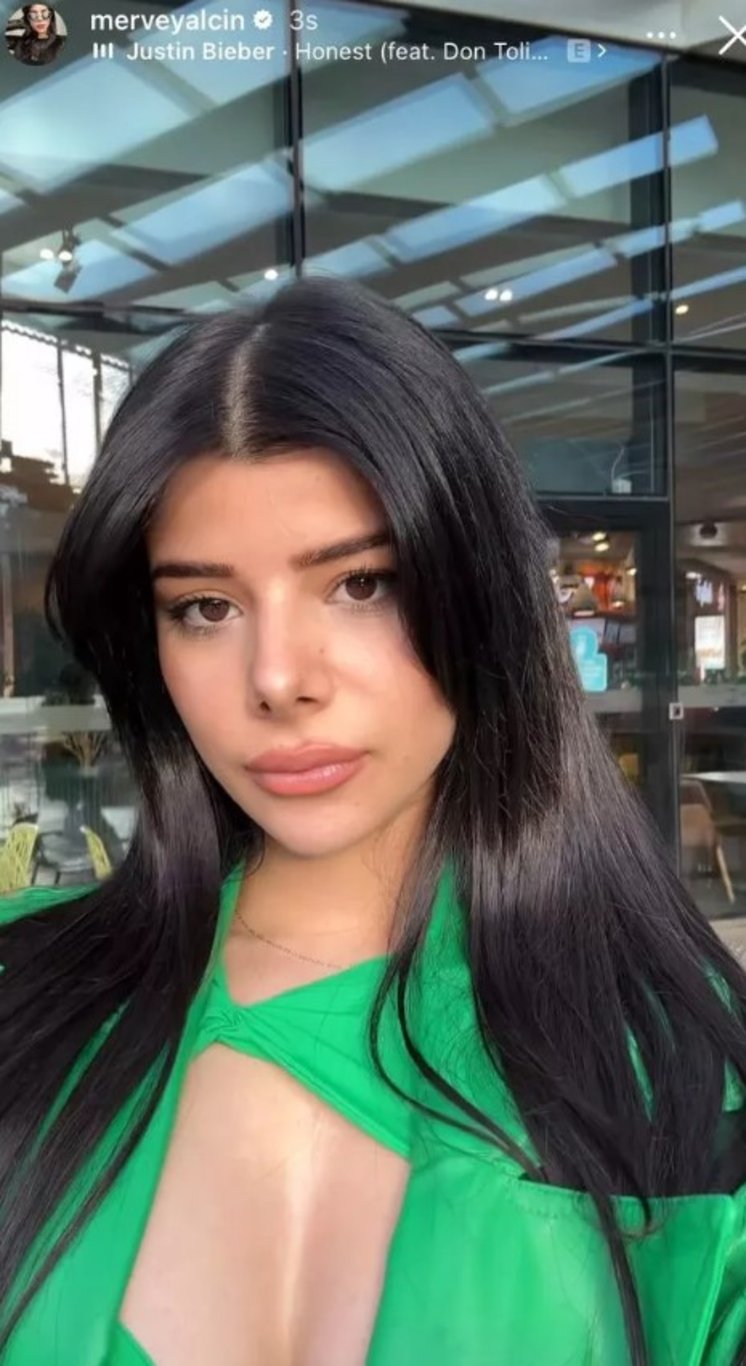 Tiktok Fenomeni Merve Yalçından Dikkat çeken Pozlar Instagramda