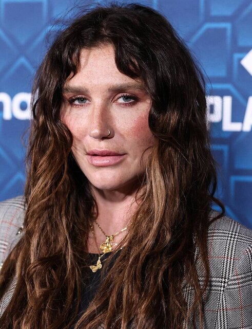 Kesha Rose Sebert: Neredeyse ölüyordum - Magazin haberleri