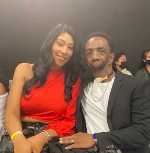 Çenesi olmadan dünyaya geldi ve gerçek aşkını bularak herkese ilham verdi