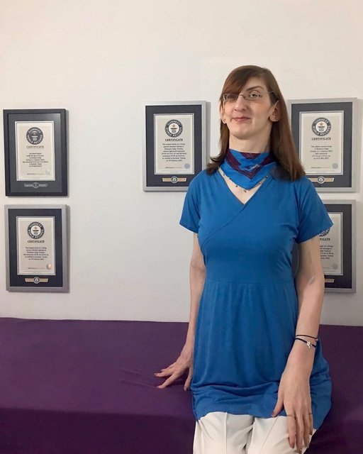 Nadir bir sendromla dünyaya gelerek yaşayan en uzun kadın rekorunu kıran Rumeysa Gelgi'nin ilham ...