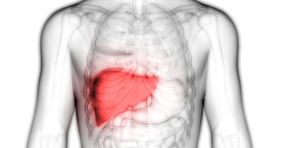 Karaciğer sirozu nedir? Siroz belirtileri nelerdir? | Sağlık Haberleri