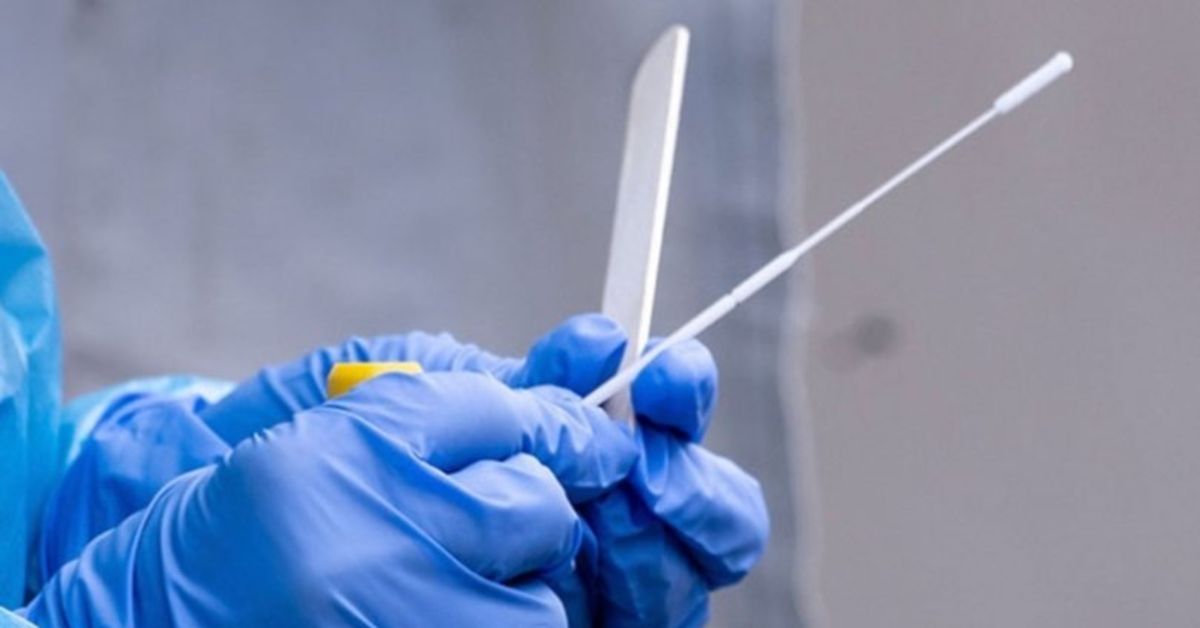 PCR testi nedir, nasıl yapılıyor? PCR testi ücretli mi?