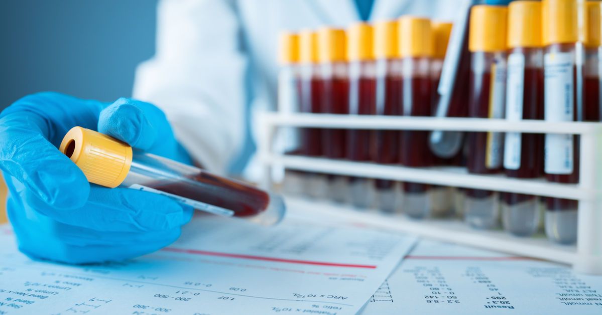 eGFR Nedir, Neden Olur ve Normal Değeri Kaç Olmalı? eGFR Düşüklüğü ...