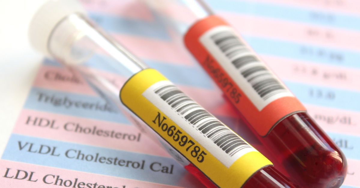 HDL Kolesterol Nedir, Neden Olur ve Normal Değeri Kaç Olmalı? HDL ...