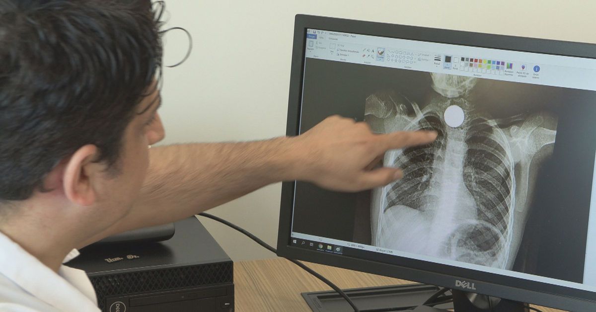 Disk pillere dikkat! Tehlike büyük! | Sağlık Haberleri