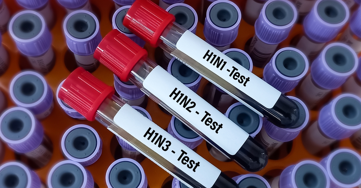 İngiltere'de H1N2 grip türü ilk kez insanda görüldü | Sağlık Haberleri
