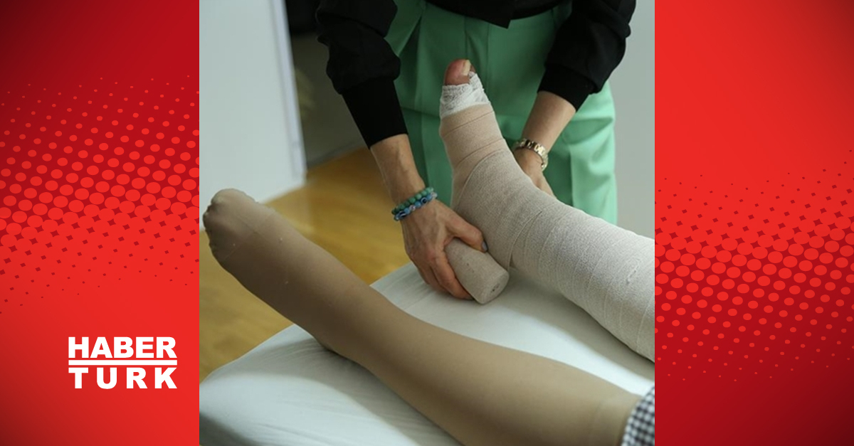 Fil hastalığında sülük tedavisi çare değil dert olabilir | Sağlık Haberleri