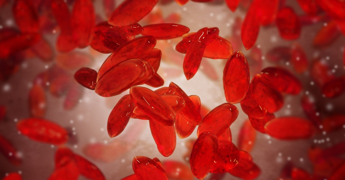 ABD'de bir kişi hıyarcıklı veba teşhisiyle tedavi altına alındı ...