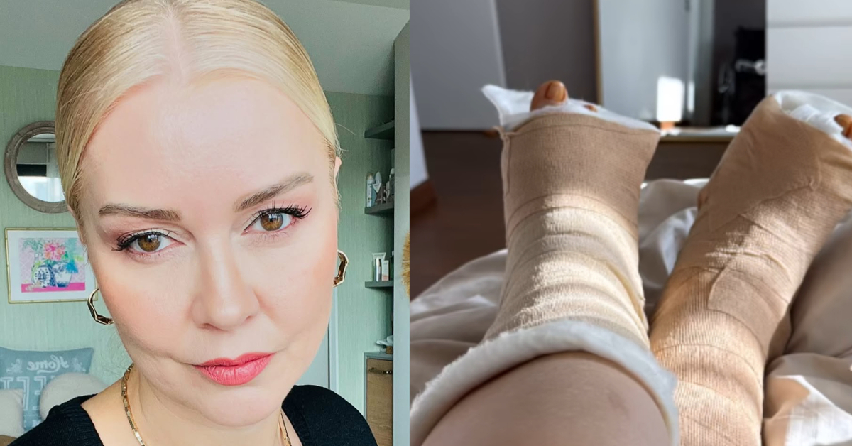 Didem Uzel ayaklarından ameliyat oldu - Magazin haberleri