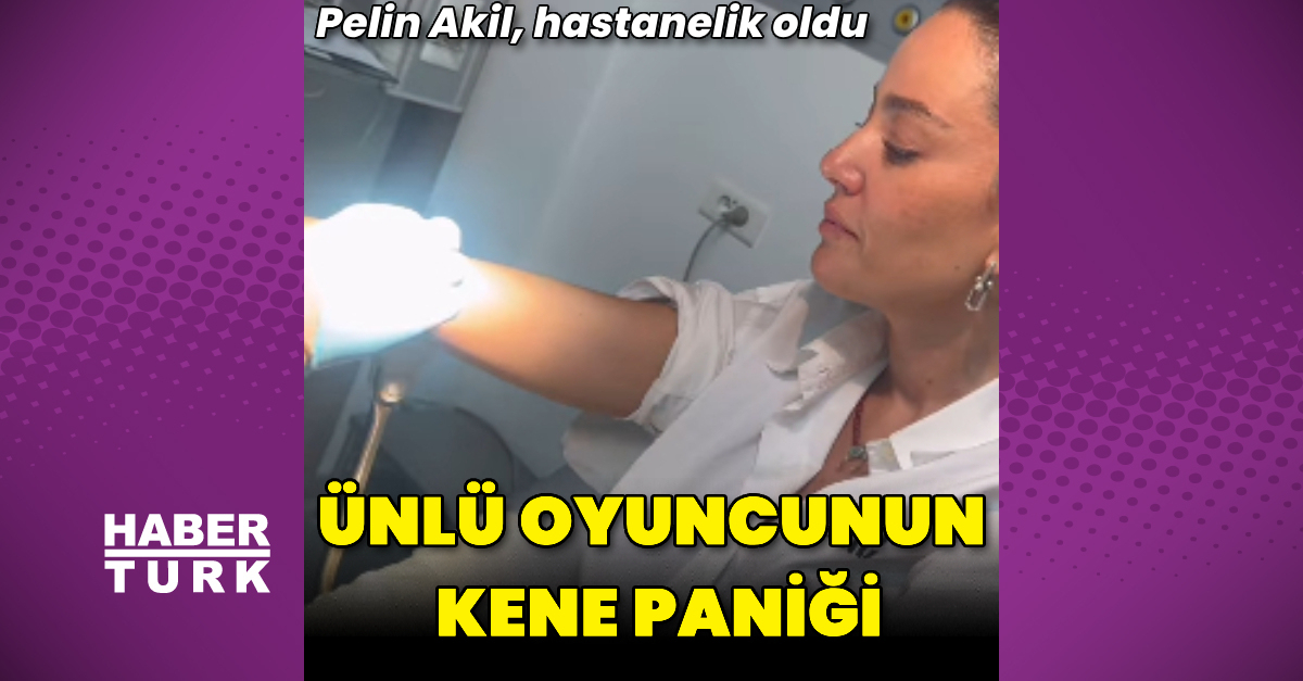 Pelin Akil'in koluna kene yapıştı - Magazin haberleri