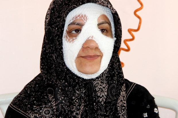 Bomba gibi patlayan düdüklü tencere genç kadına dehşeti yaşattı Düdüklü ...